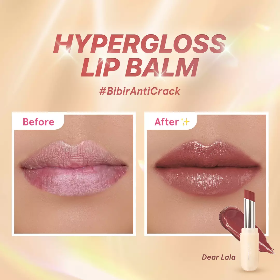 Jual Dear Me Beauty Dear Me Beauty Hypergloss Lip Balm - Dear Winna ...