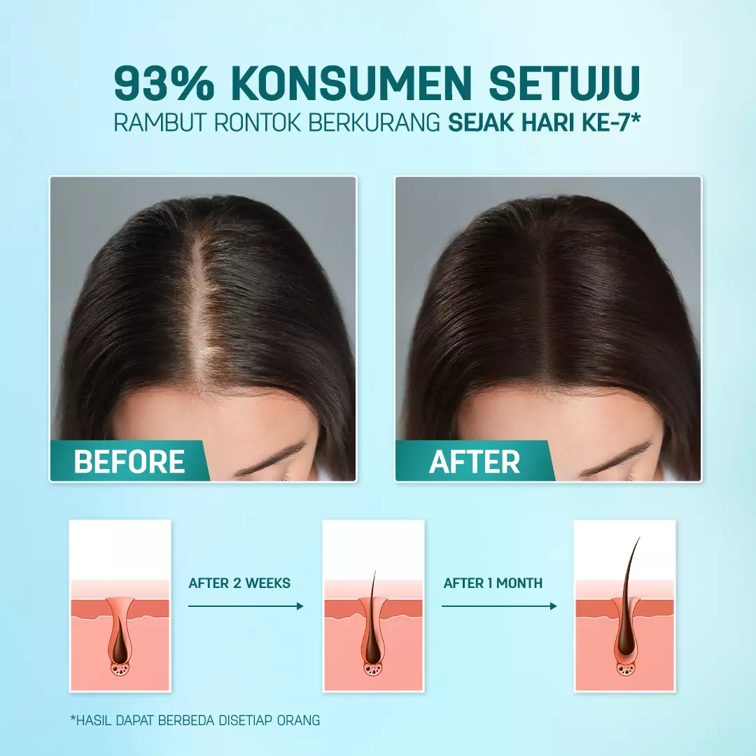 Jual Erha Erha Erhair Hair Grow Tonic With Keratin & Biotin 60Ml ...