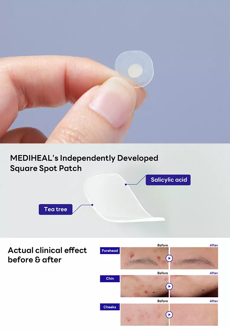Buy Mediheal Derma Clear Teatree Trouble Spot Patch, 44 pcs - Acne ...