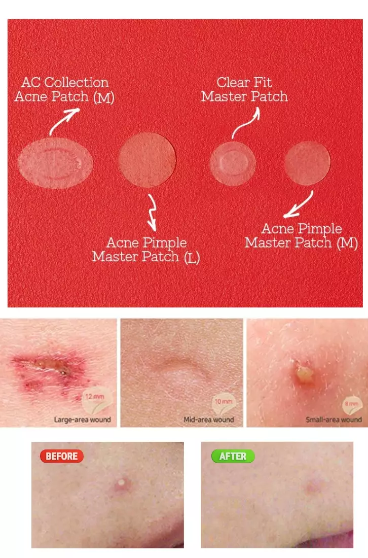 Buy COSRX Cosrx Acne Patch Mix & Match(1X Acne Pimple ,Clear Fit,AC ...